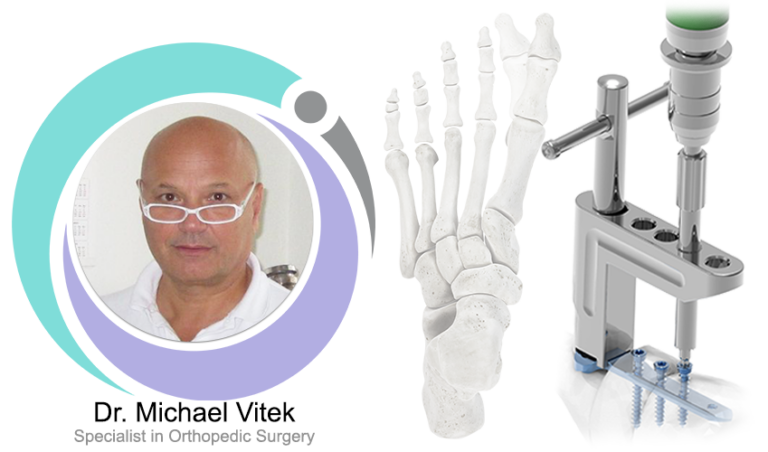 Hallux and Forefoot Philosophy - Minimally Invasive V-TEK system ...