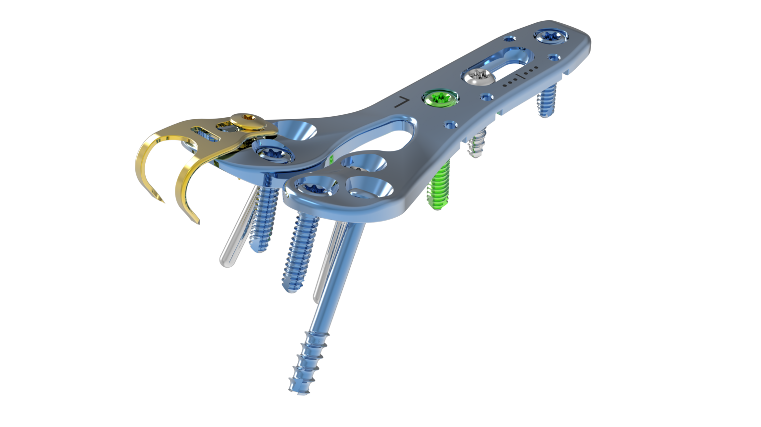 Volar-e system for Radius and Ulna - Astrolabe
