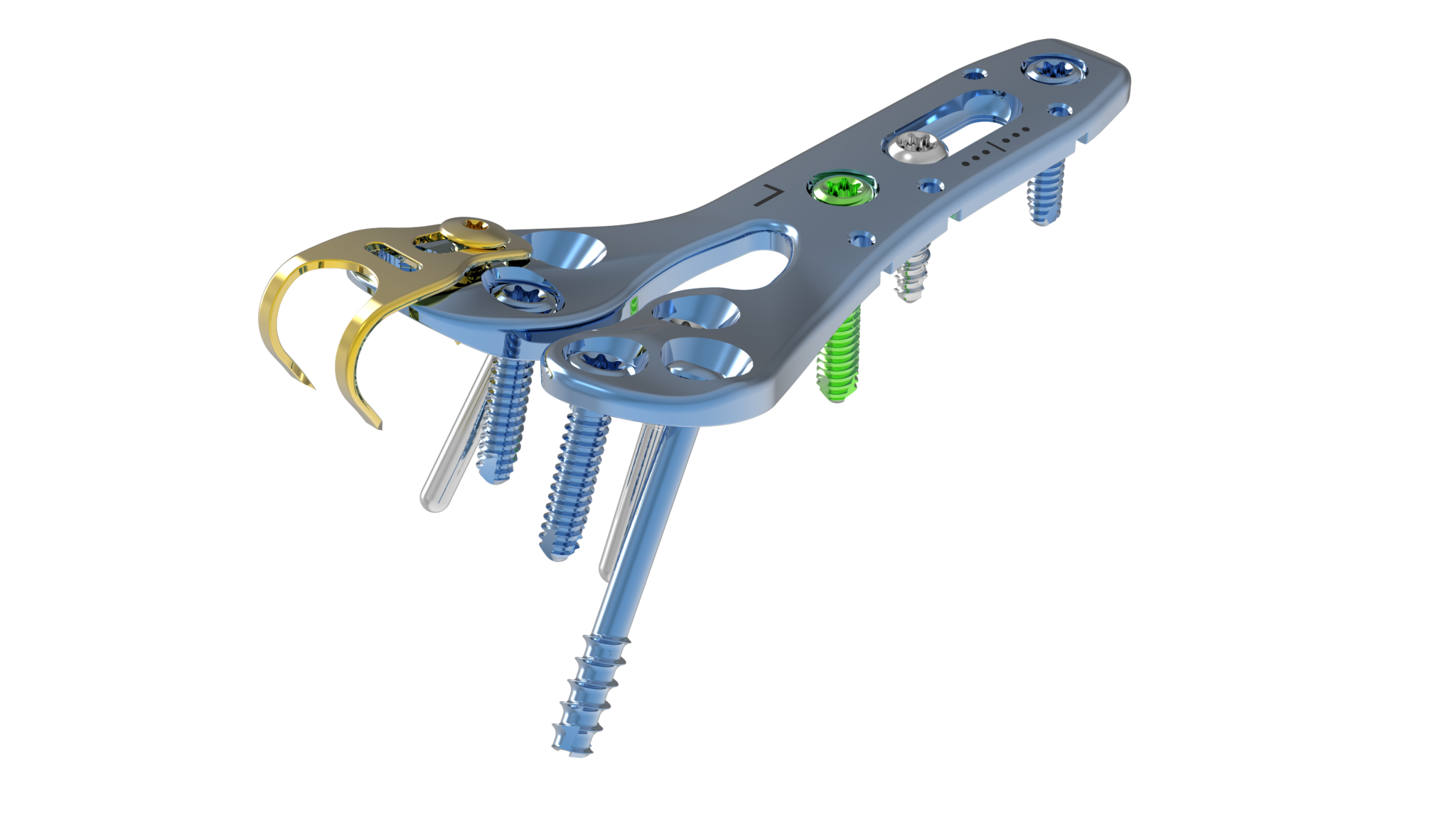 Volar-e system for Radius and Ulna - Astrolabe